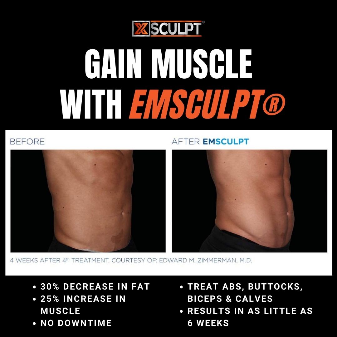 Specials & Promotions | XSculpt Chicago